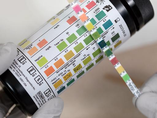 Point of Care Diagnostics