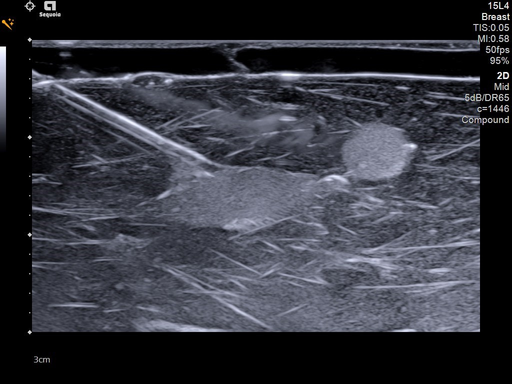 ACUSON Sequoia Ultrasound System - Siemens Healthineers