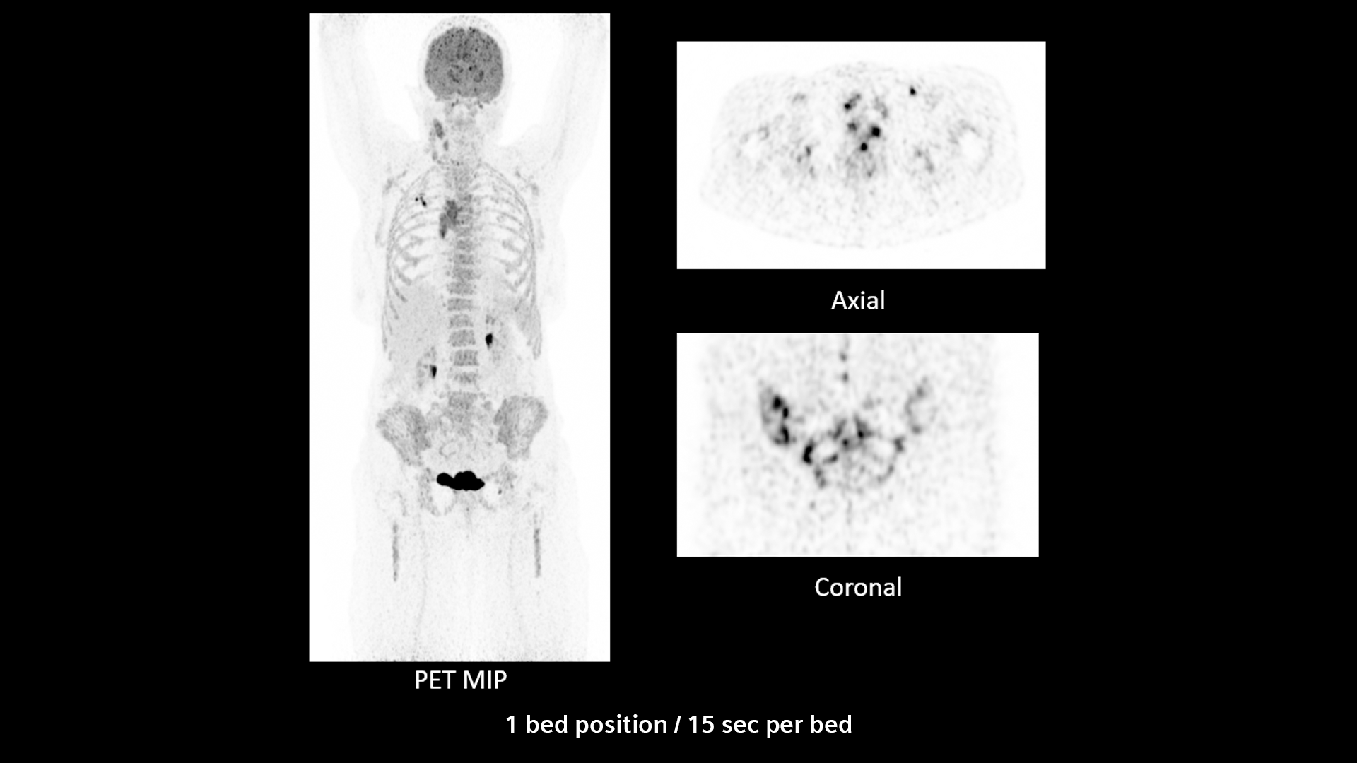 Biograph Vision Quadra PET/CT Scanner - Siemens Healthineers