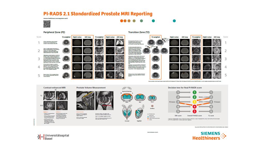 Order your MRI Poster