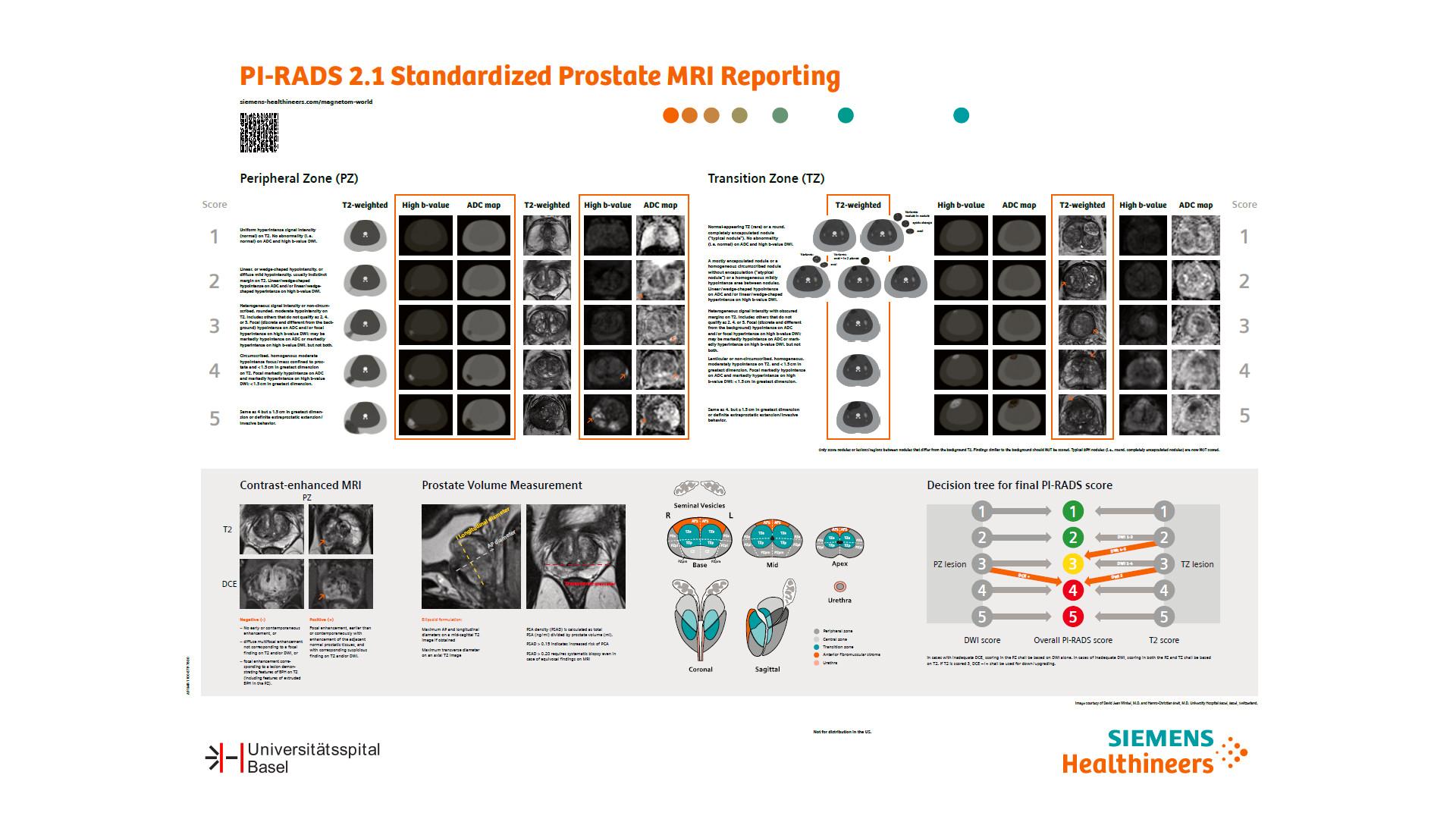 Order your MRI Poster