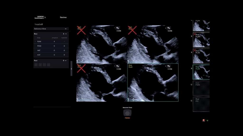 ACUSON Origin Cardiovascular Ultrasound System - Siemens Healthineers USA