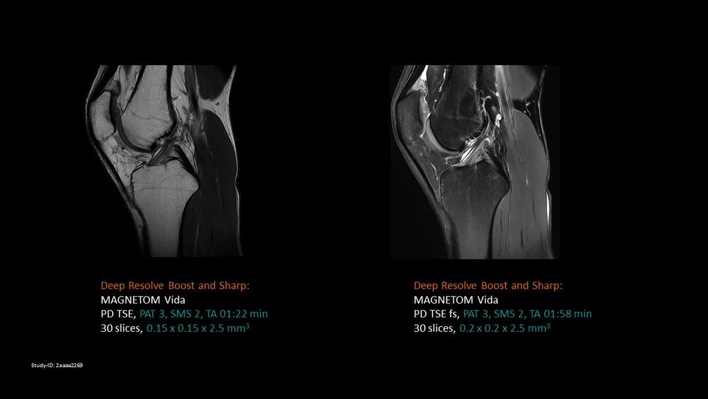 Deep Resolve - Siemens Healthineers Japan