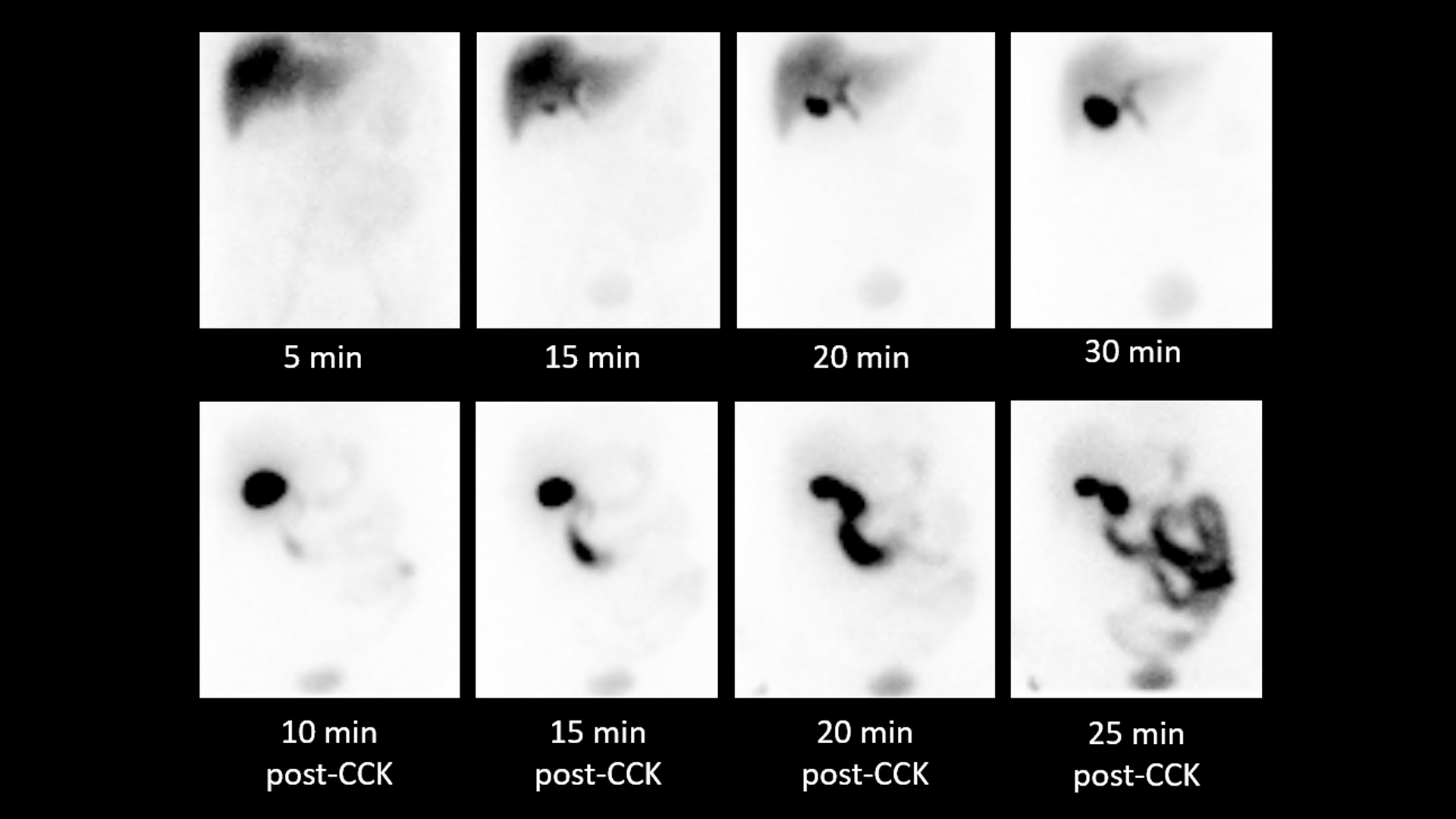 Symbia Pro.specta SPECT/CT - Siemens Healthineers Canada