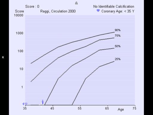 CT calcium scoring: Ultra low dose coronary Ca scoring screening ...