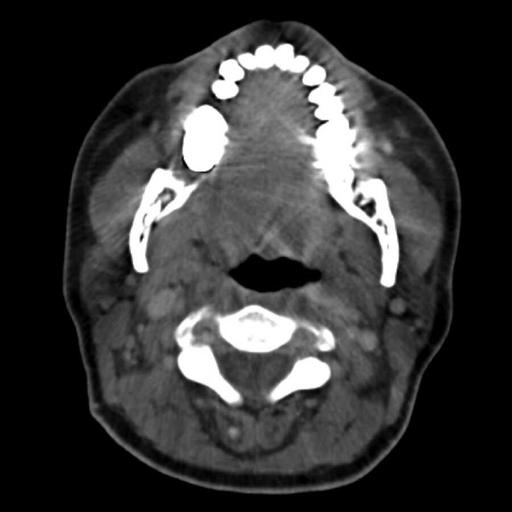 iMAR - Siemens Healthineers