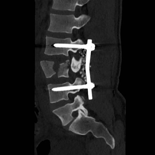 iMAR - Siemens Healthineers España