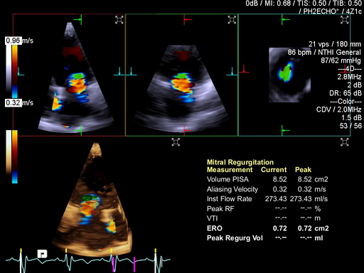 ACUSON SC2000 Cardiovascular Ultrasound System - Siemens Healthineers USA