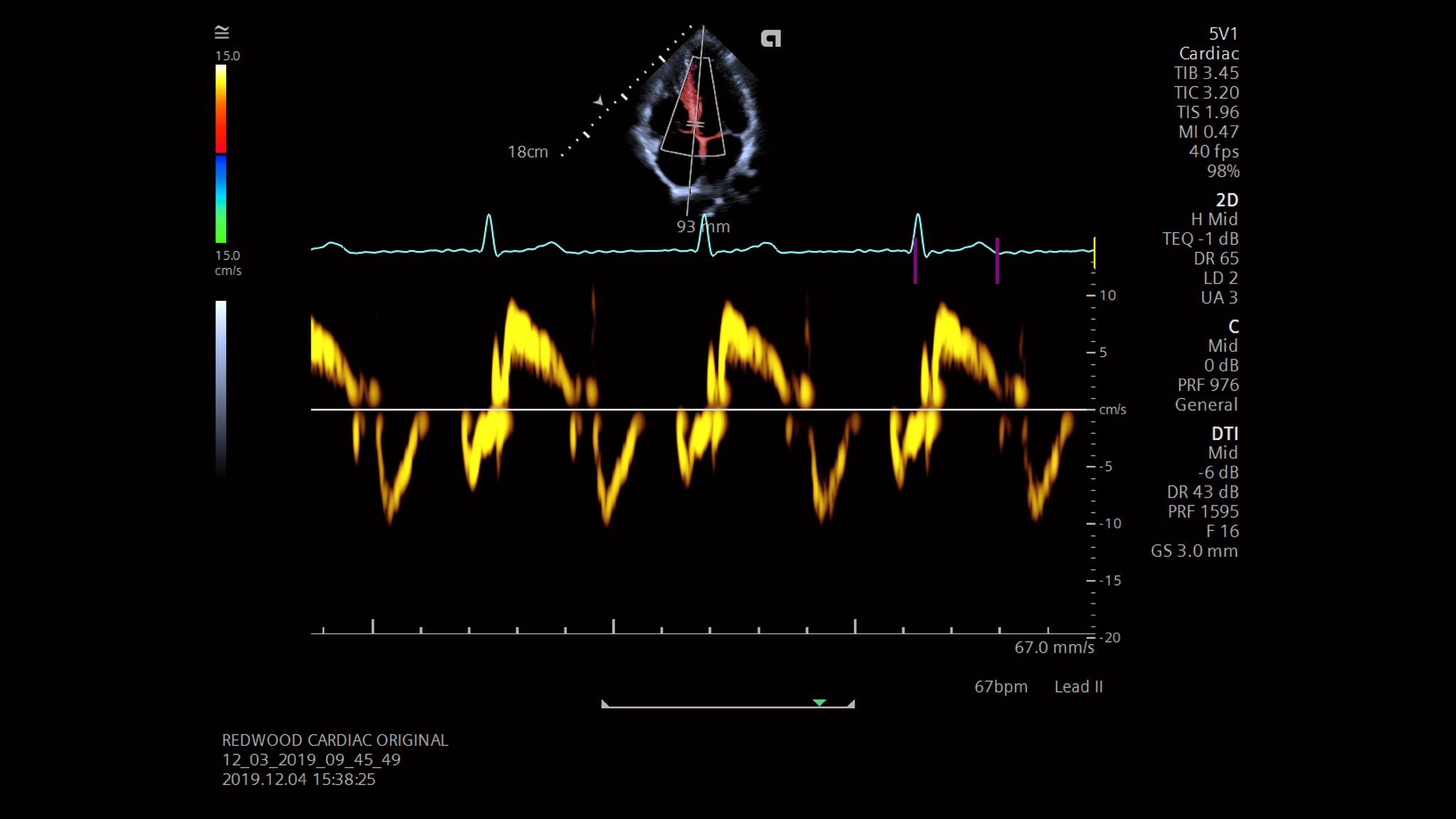 A New Era for Cardiac Ultrasound - Siemens Healthineers Malaysia