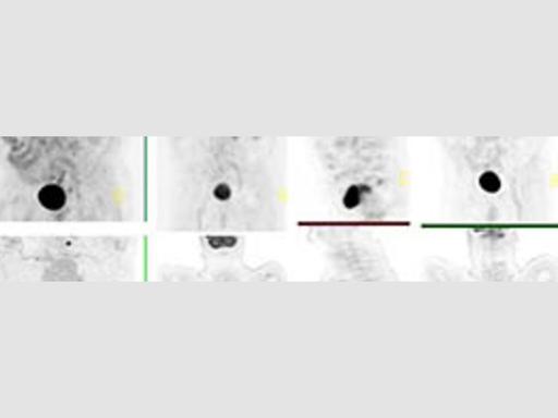 Biograph mCT Flow - Siemens Healthineers Türkiye