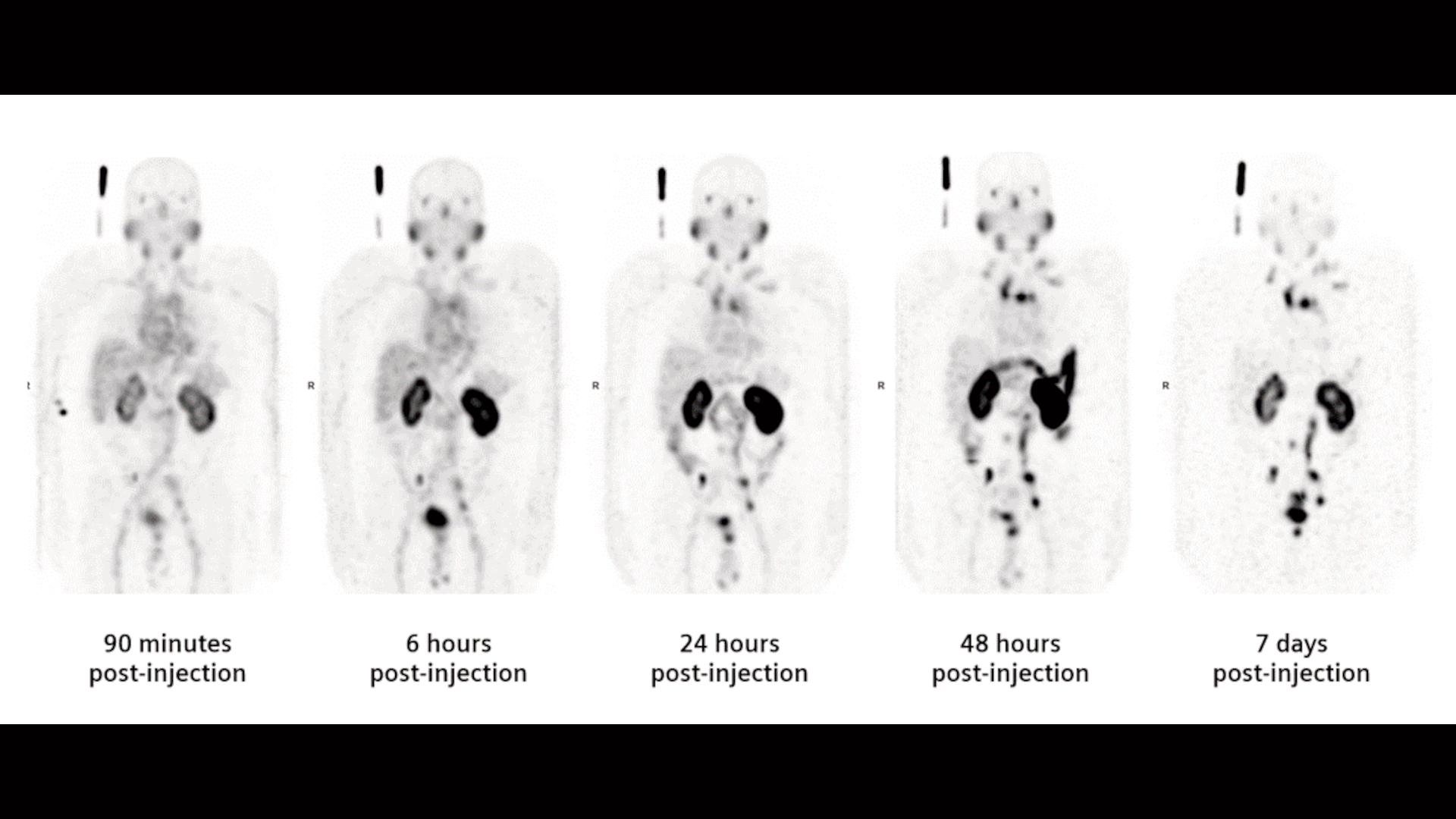 Tumor And Organ Dosimetry From Sequential Quantitative Spect Ct