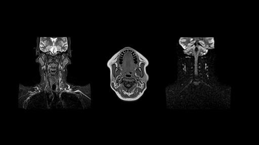 MAGNETOM Free.Max – Open Bore MRI - Siemens Healthineers USA