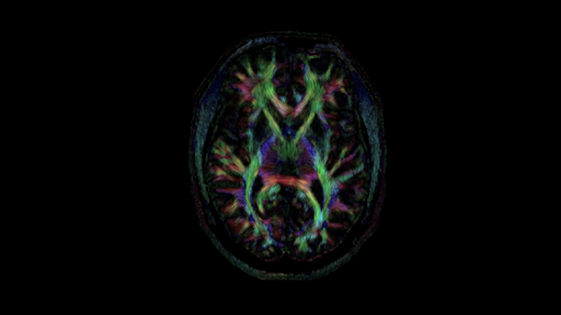 MAGNETOM Prisma - MRI Scanner - Siemens Healthineers