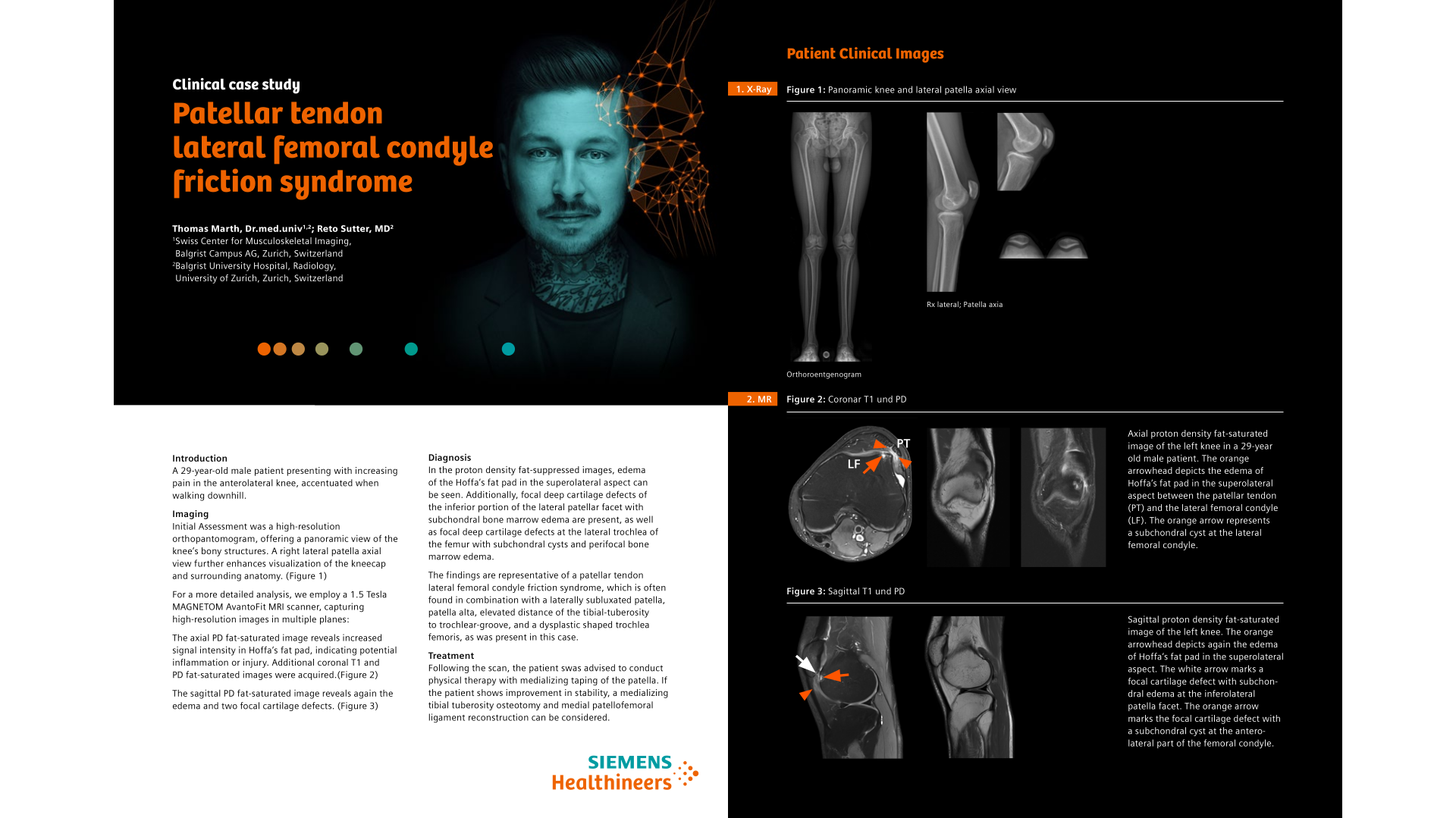 MR imaging in sports medicine - Siemens Healthineers