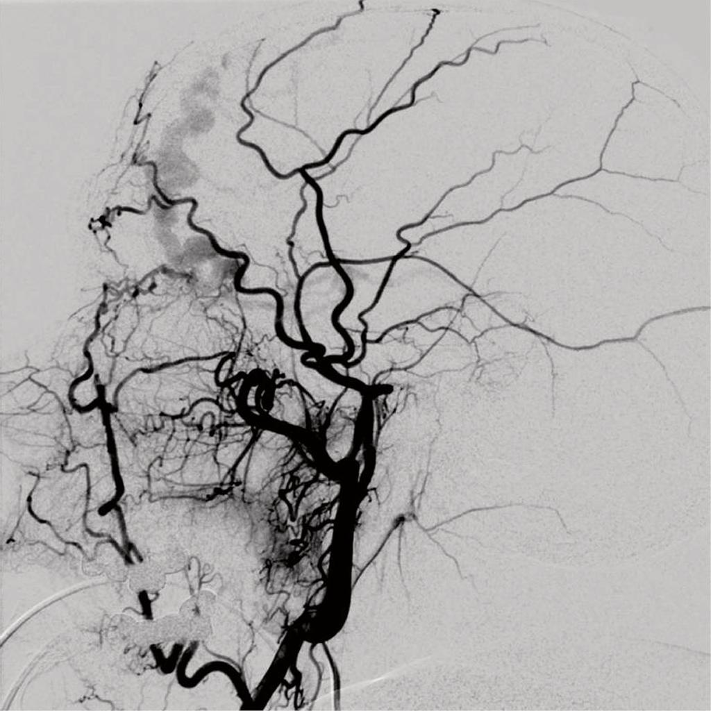 T-trendz Issue 1 / 2021 - Siemens Healthineers India