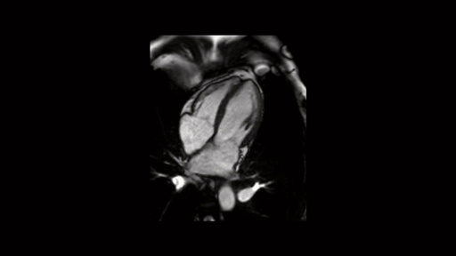 MAGNETOM Viato.Mobile - Siemens Healthineers