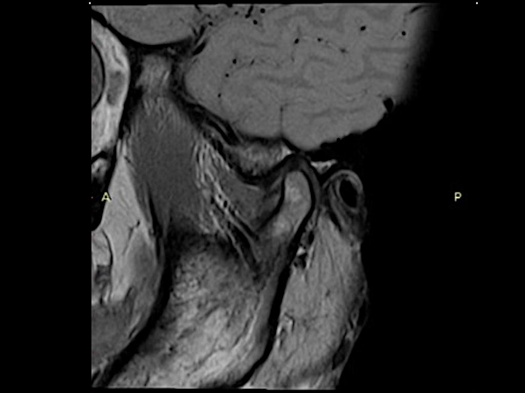 Musculoskeletal MRI