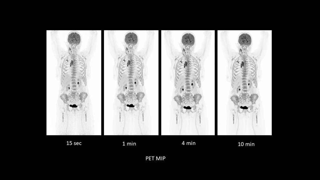 Biograph Vision Quadra - Siemens Healthineers USA