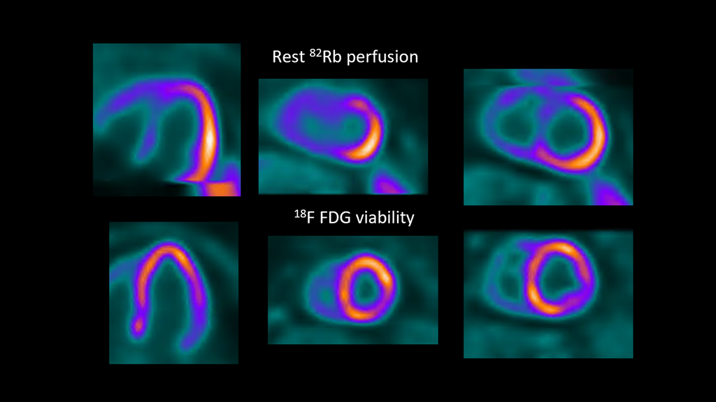 PETNET on cardiology - Siemens Healthineers USA