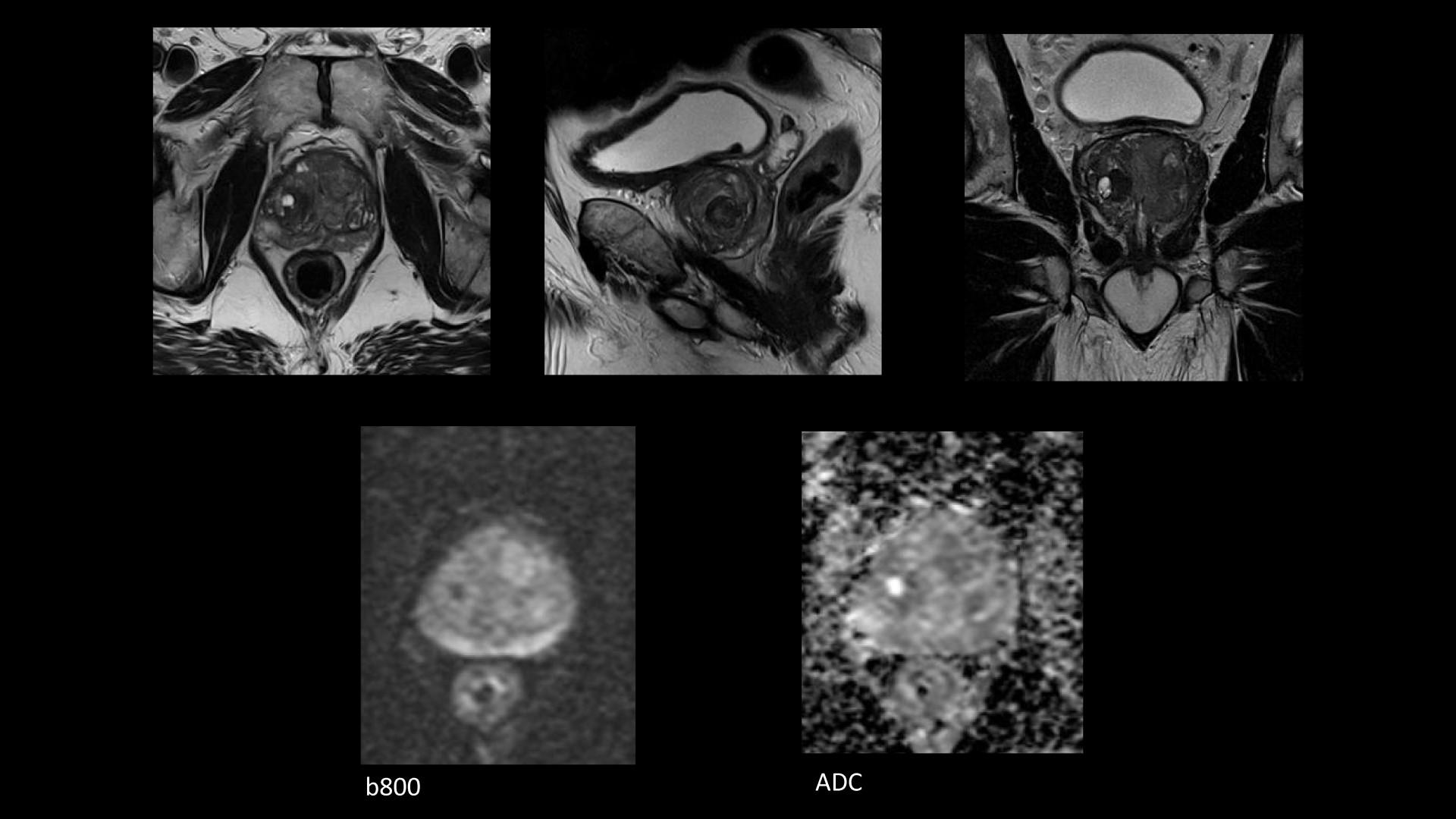 BioMatrix Contour Coils - Siemens Healthineers