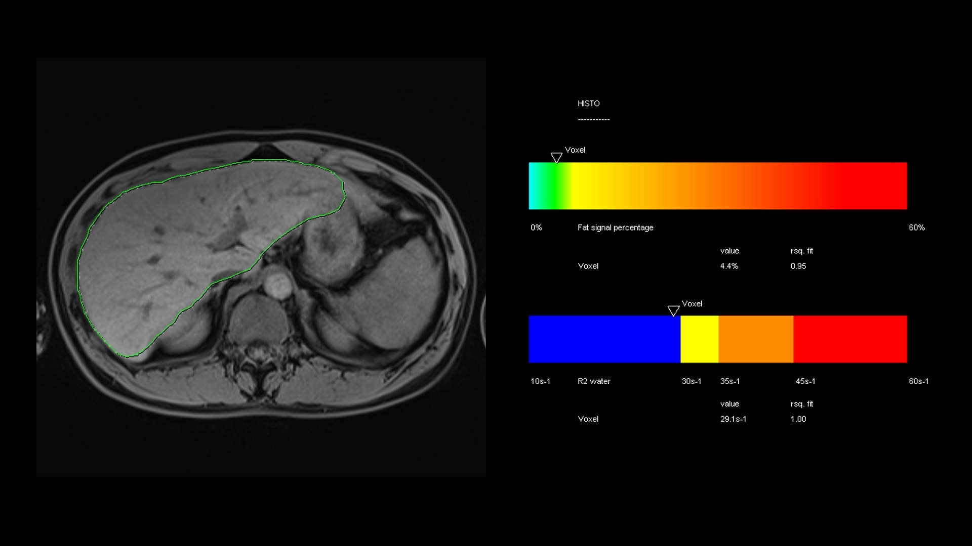 Exceleration Edition - Siemens Healthineers Brasil