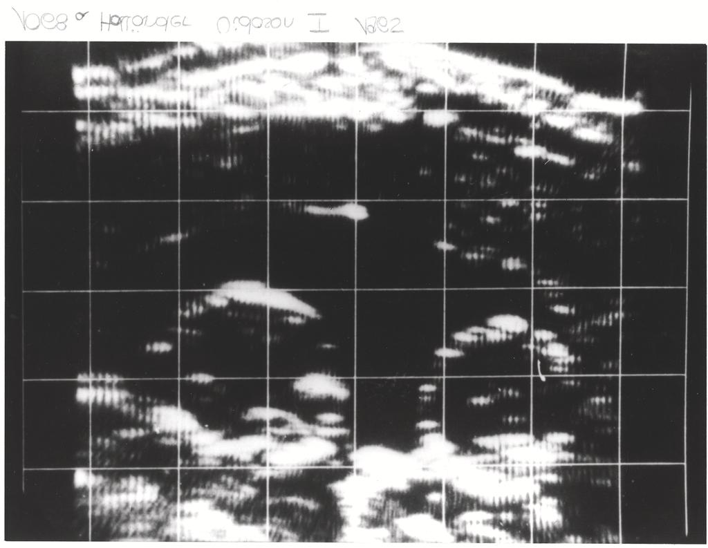 Milestones in Ultrasound Diagnostics - Siemens Healthineers USA