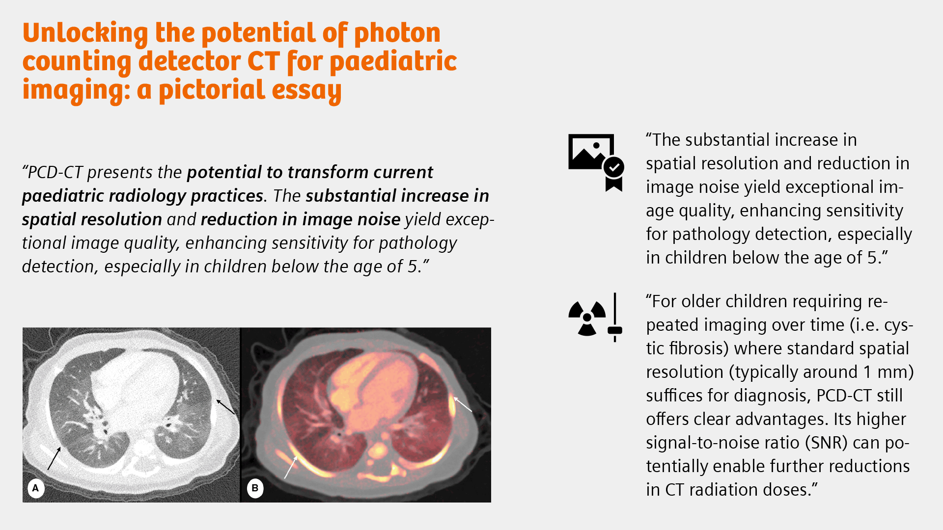 Unlocking the potential of photon counting detector CT for paediatric ...
