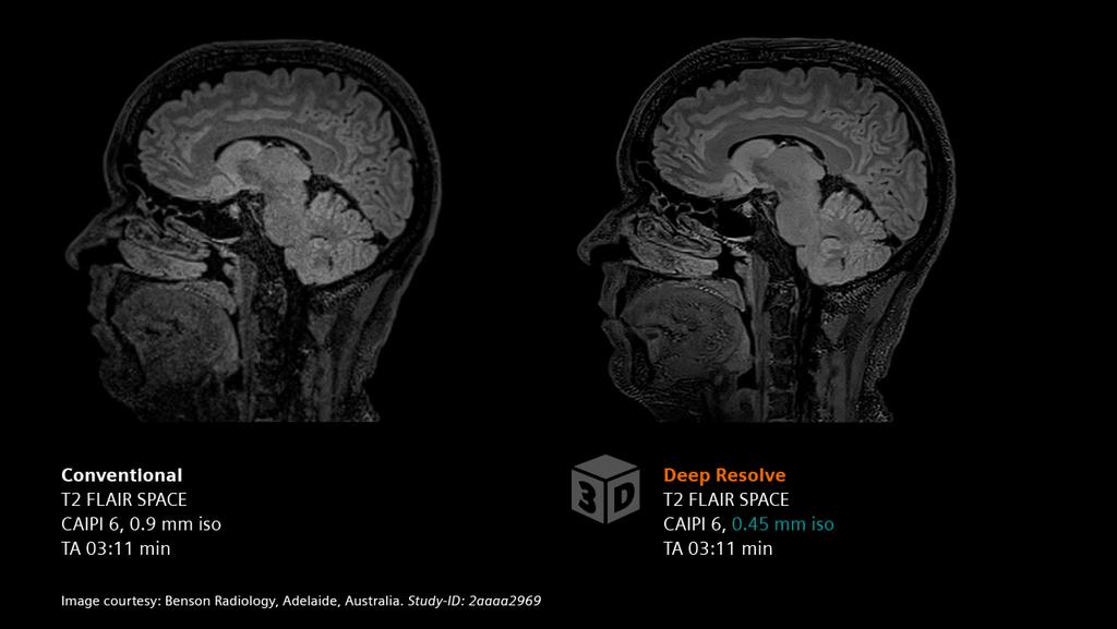 Deep Resolve – Siemens Healthineers Deutschland