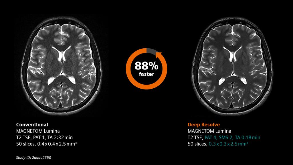 Deep Resolve - Siemens Healthineers