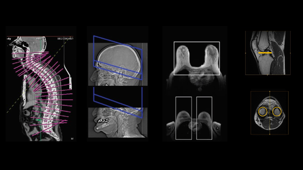 Automatic landmarking and parsing of human anatomy (ALPHA) for ...