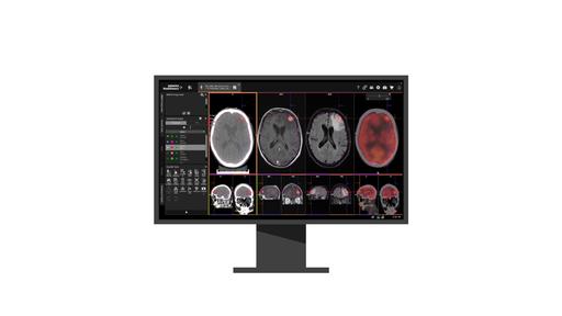 Autocontouring in radiation therapy - Siemens Healthineers - Siemens ...