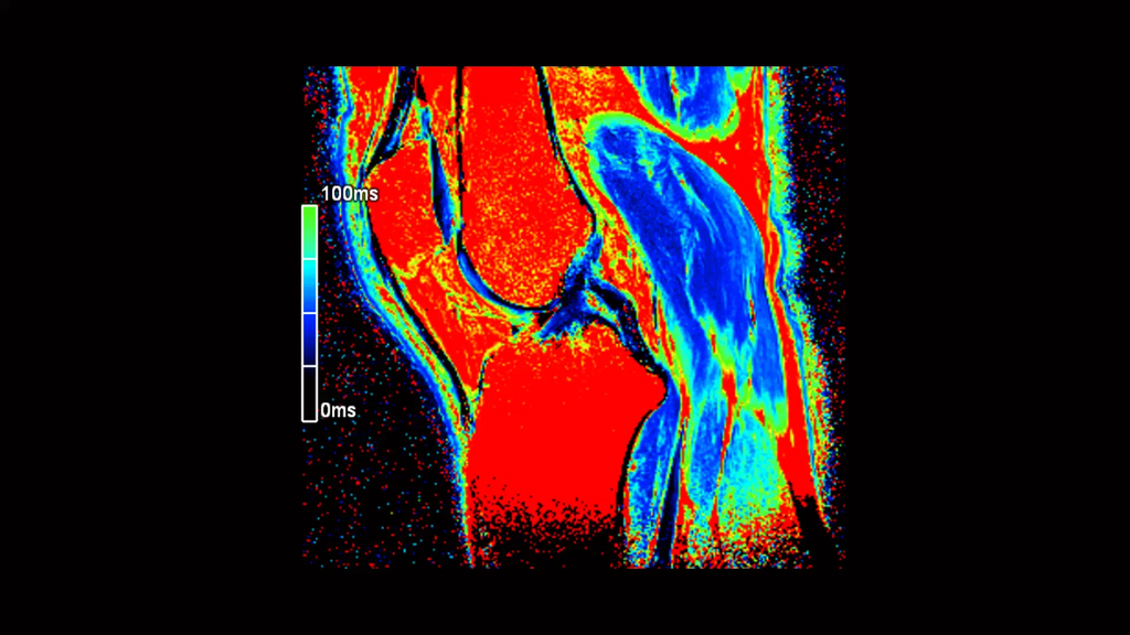 Musculoskeletal Imaging - Siemens Healthineers