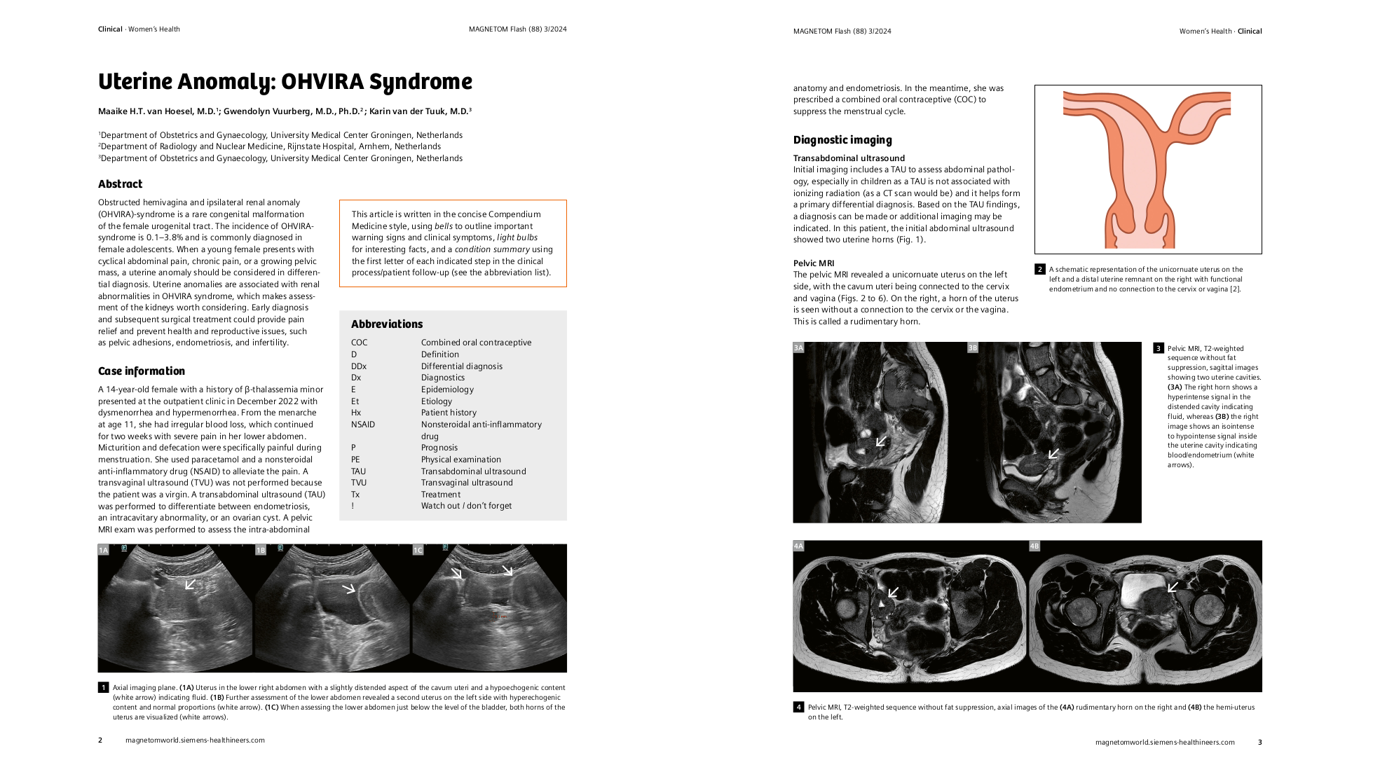 Uterine Anomaly: OHVIRA Syndrome