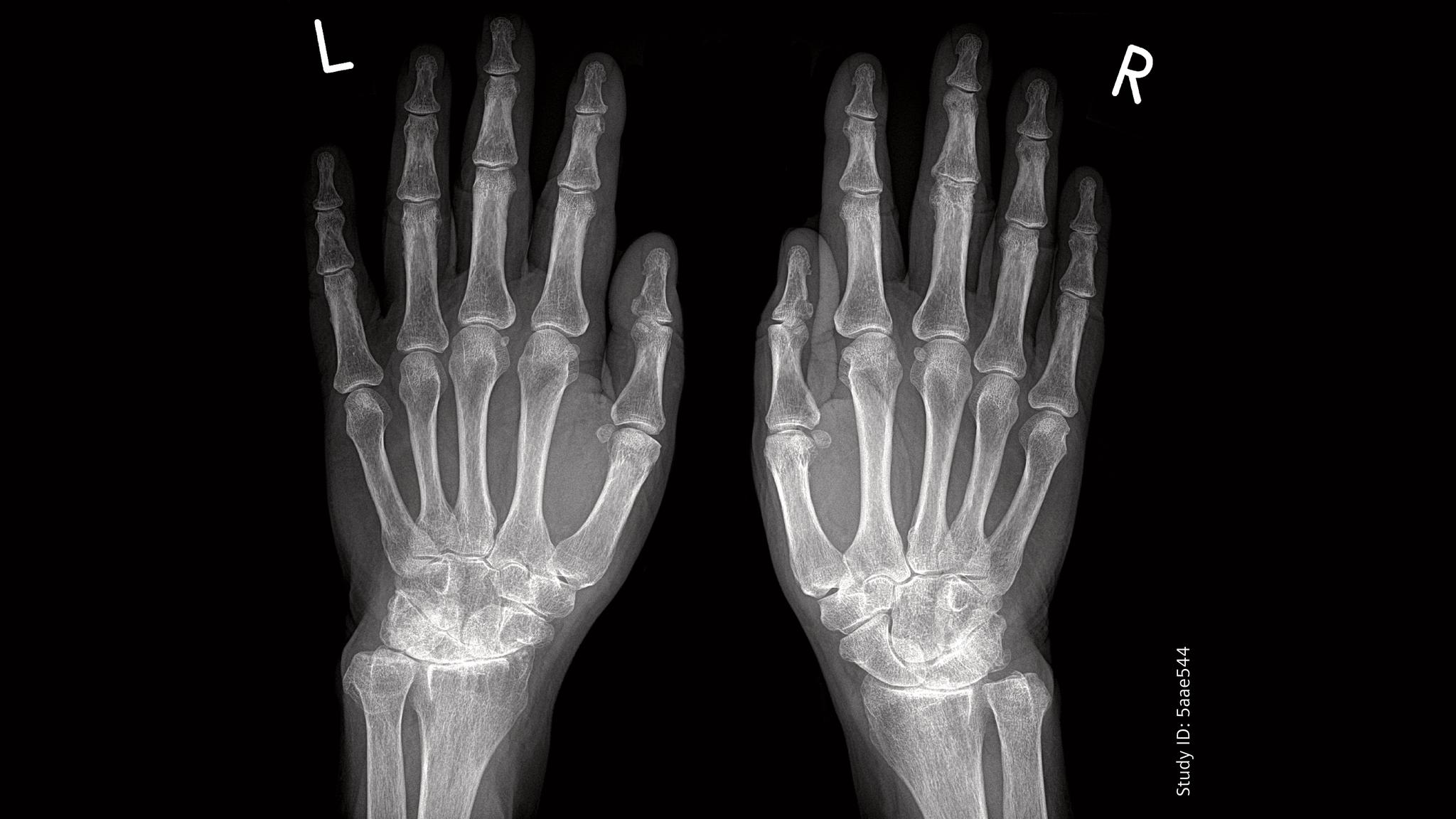 MOBILETT Impact - Siemens Healthineers