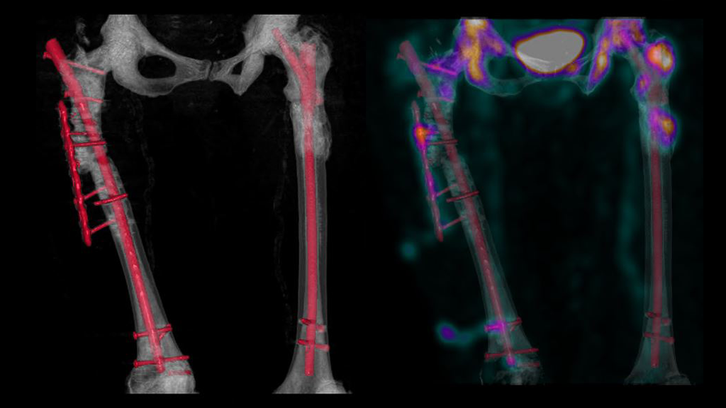 Molecular Imaging Systems - Siemens Healthineers USA