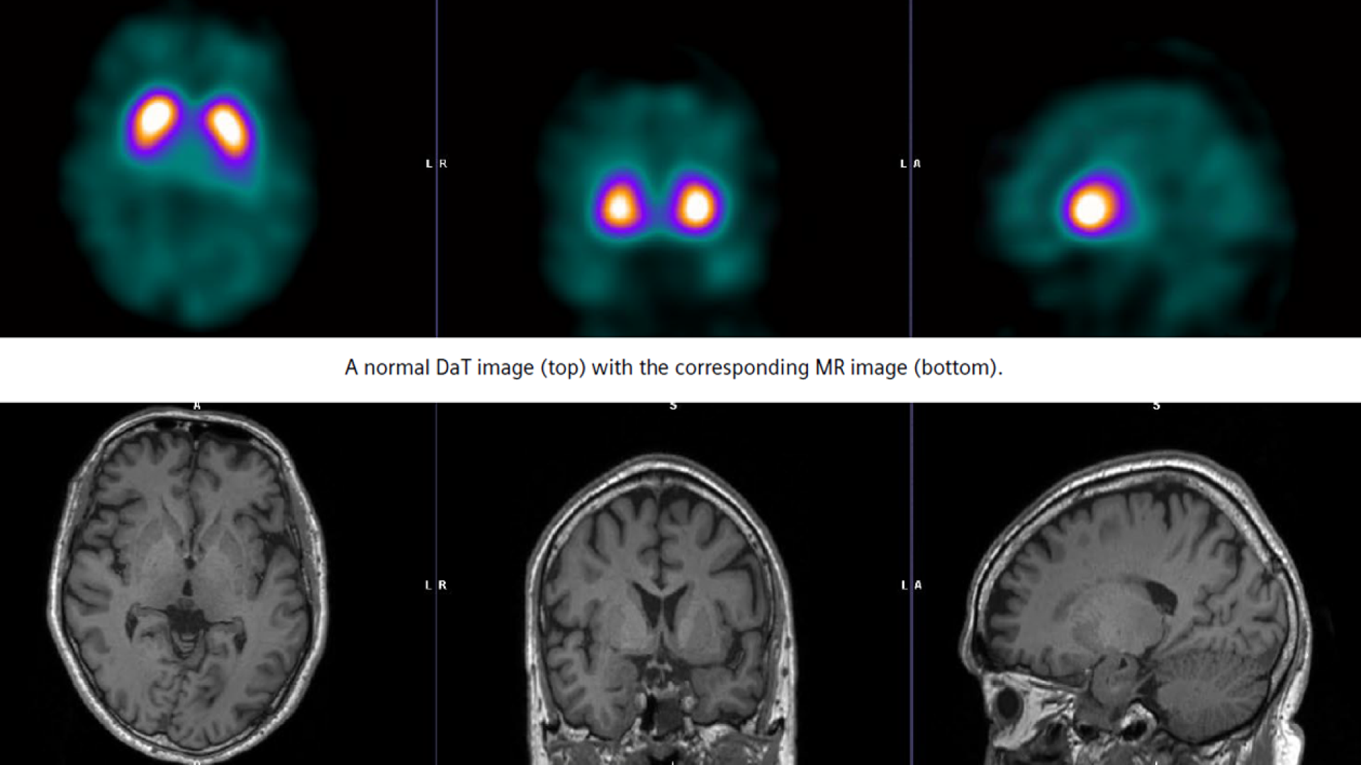 An examination of nuclear neurology in Japan - Siemens Healthineers USA