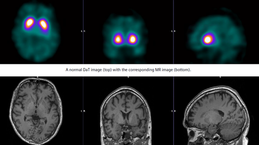 An examination of nuclear neurology in Japan - Siemens Healthineers USA