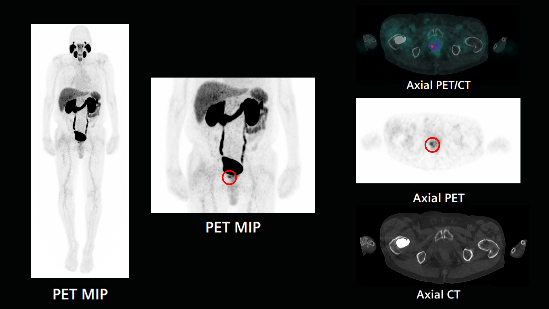 Theranostics center of excellence: transforming oncology care - Siemens ...