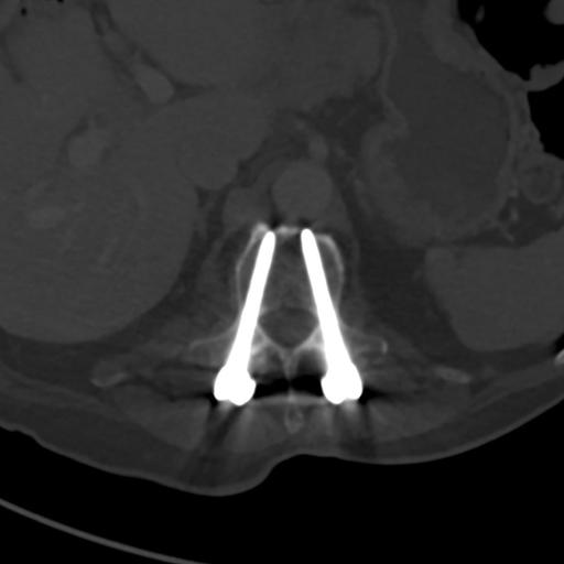 iMAR - Siemens Healthineers