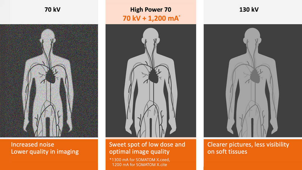 The SOMATOM X. platform – Intelligent imaging - Siemens Healthineers USA