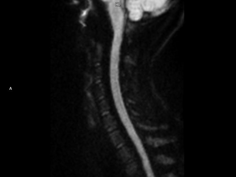 Sagittal RESOLVE Diffusion-MAGNETOM Lumina - Siemens Healthineers USA