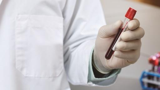 Real-World Evidence & Value of the ELF Test - Siemens Healthineers