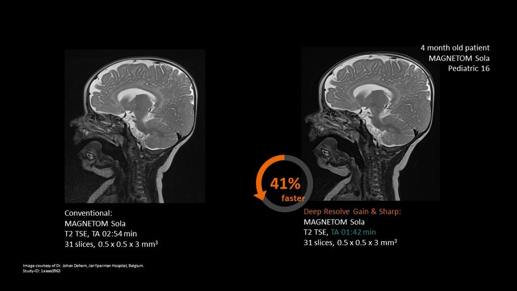 Deep Resolve - Siemens Healthineers USA
