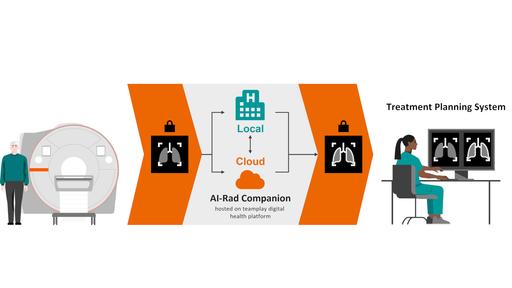 Autocontouring in radiation therapy - Siemens Healthineers - Siemens ...