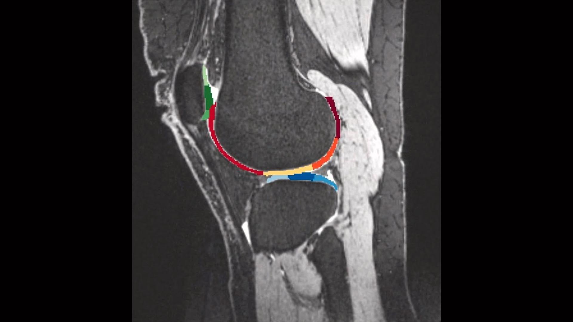 Musculoskeletal Imaging - Siemens Healthineers