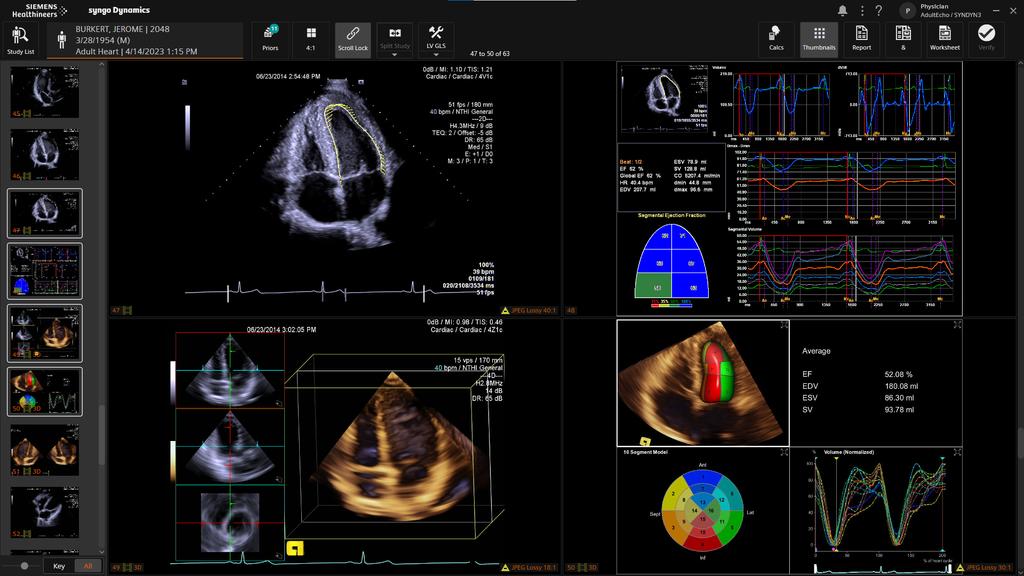 What Would Happen if You Could Better Manage Cardiovascular Imaging ...