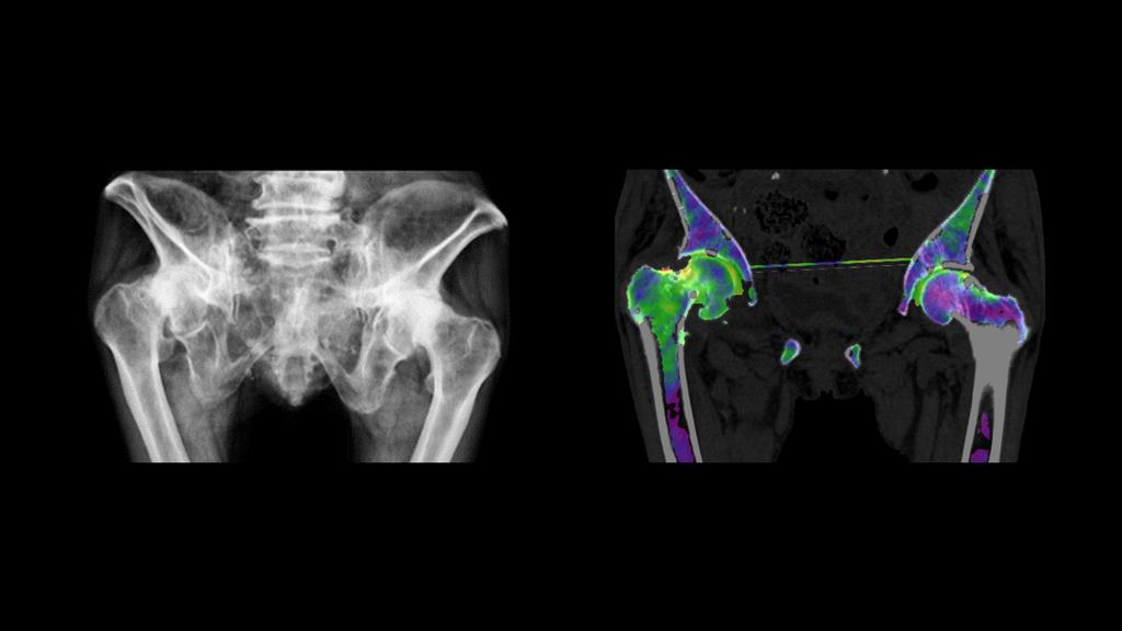 SOMATOM Drive eco – CT Scanner - Siemens Healthineers
