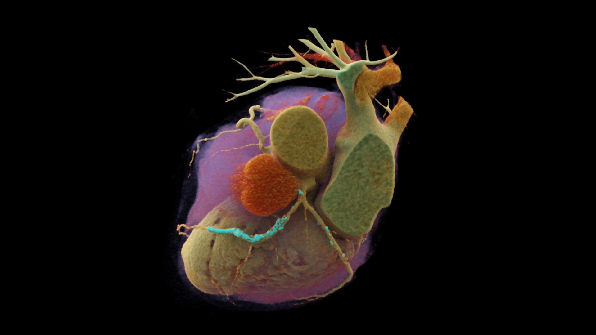 Computed Tomography - Siemens Healthineers USA