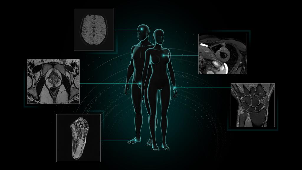 MAGNETOM Cima.X - Make the difference. - Siemens Healthineers