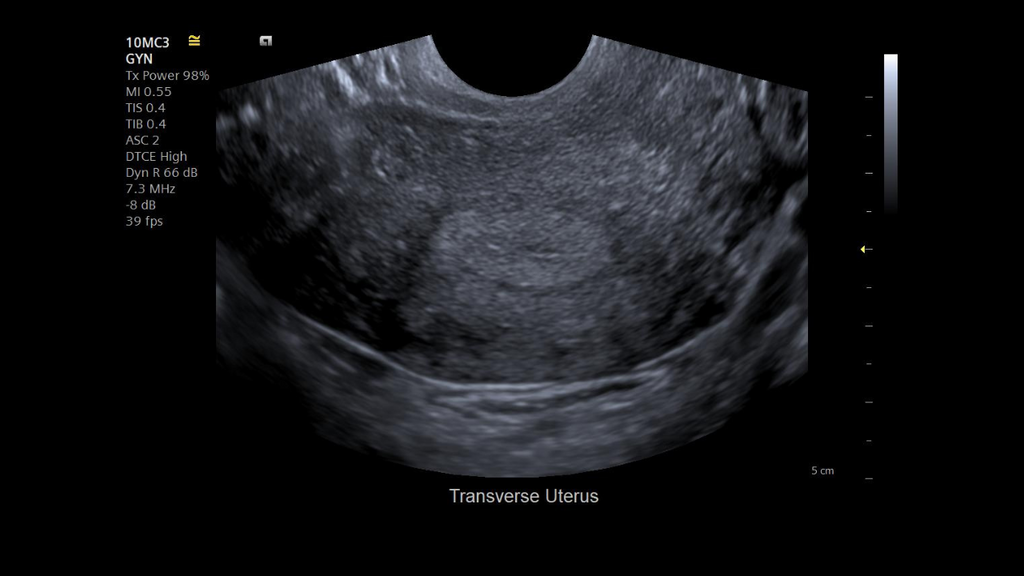ACUSON Maple is a High-Performance Shared Service Ultrasound System ...